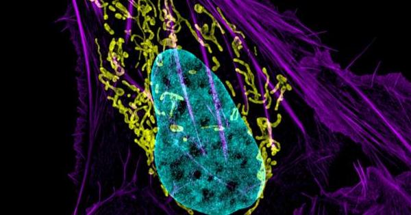 GTI & IOS Joint Event: A mitochondrial-targeted gene therapy (mLumiOpto ...